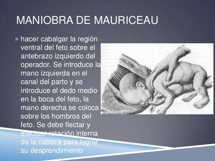 Mecanismos de parto en pelvica