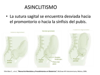 Mecanismos de trabajo de parto | PPTX