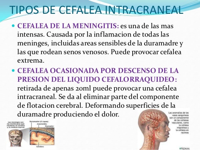 Mecanismos fisiopatologicos de la cefalea