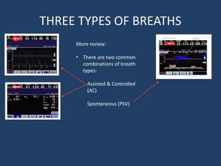 Mechancial Ventilation Part One | PPTX