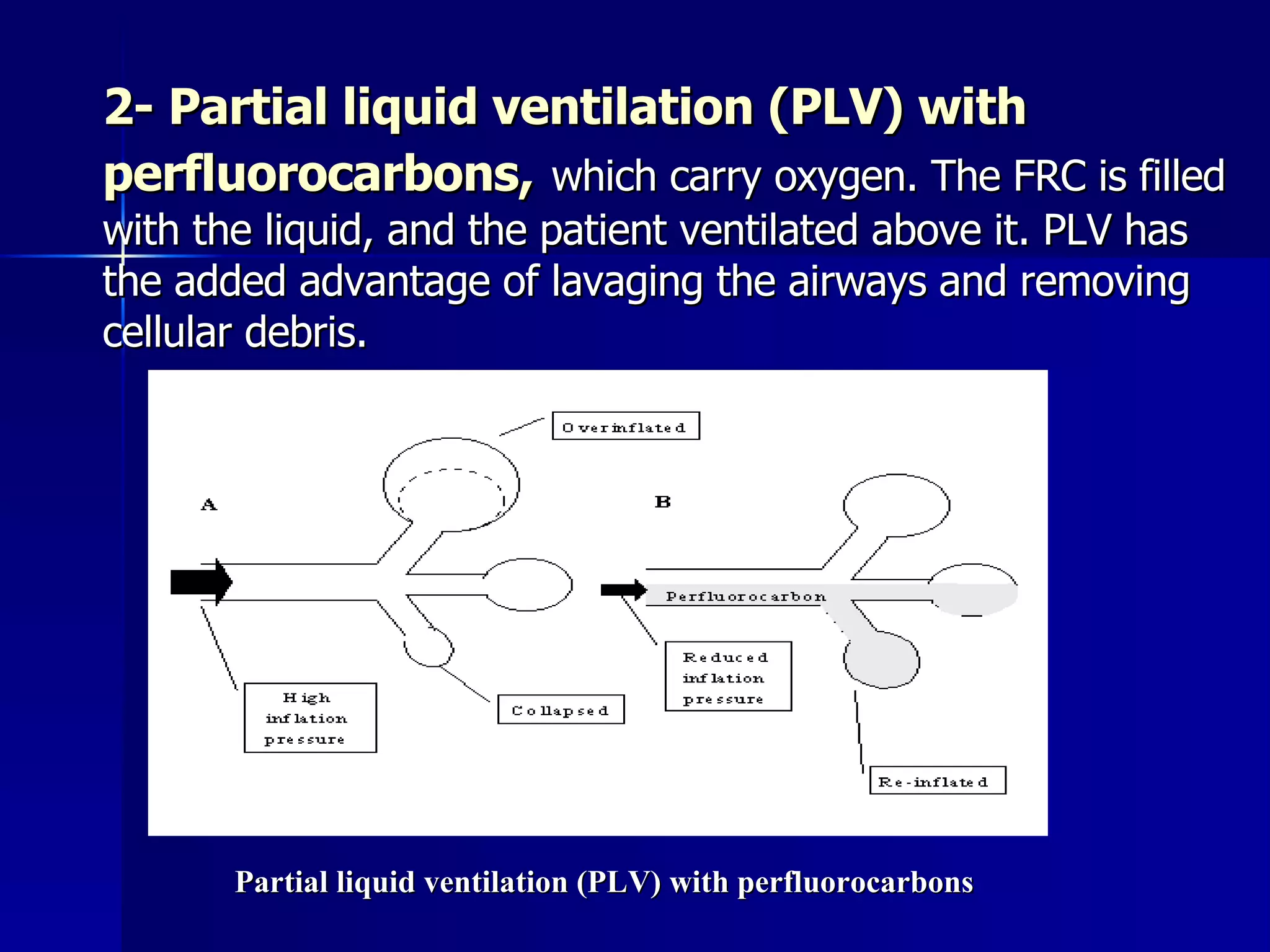 Mechanical Ventilation in ARDS vs COPD | PPT