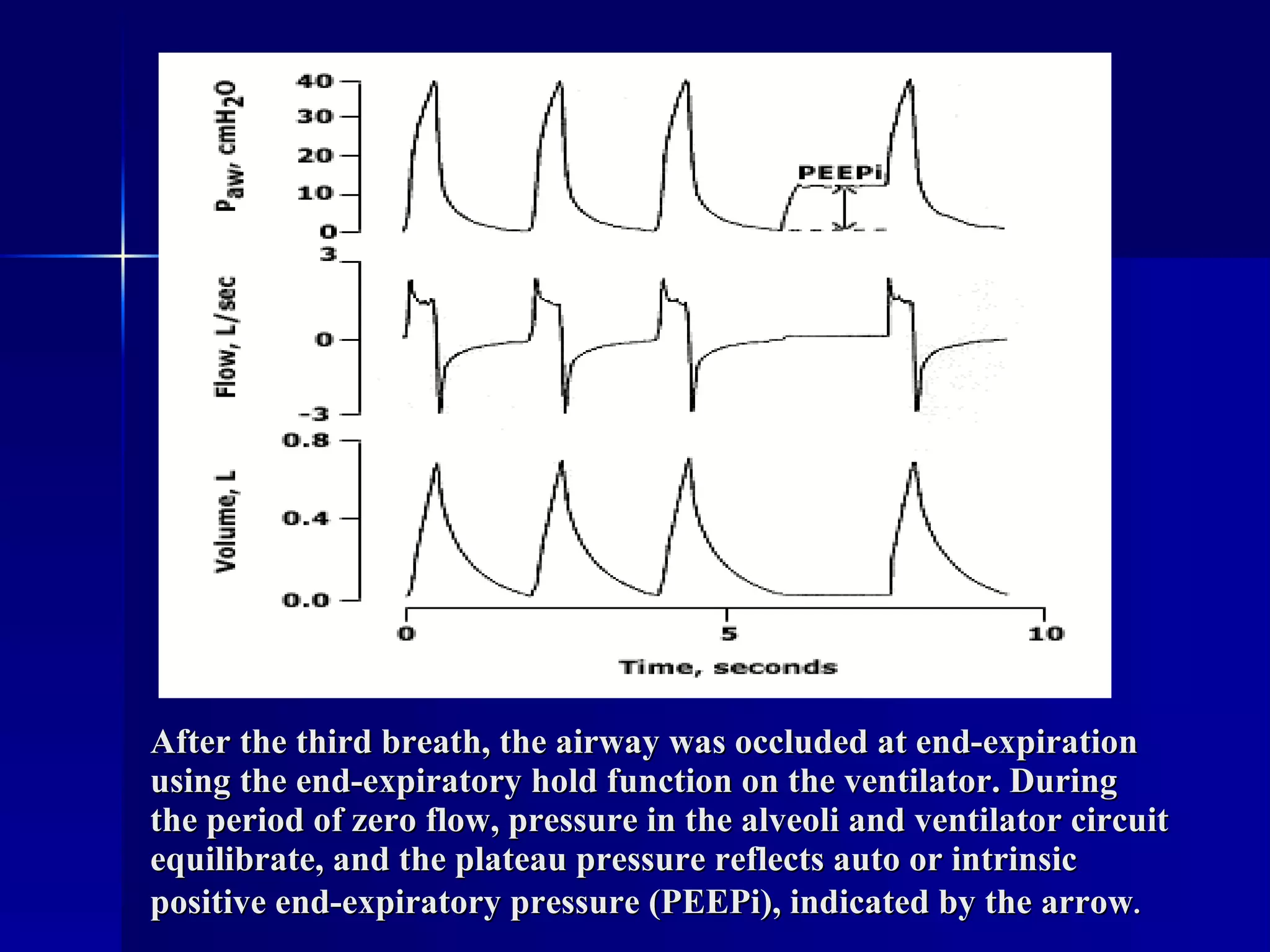 Mechanical Ventilation in ARDS vs COPD | PPT