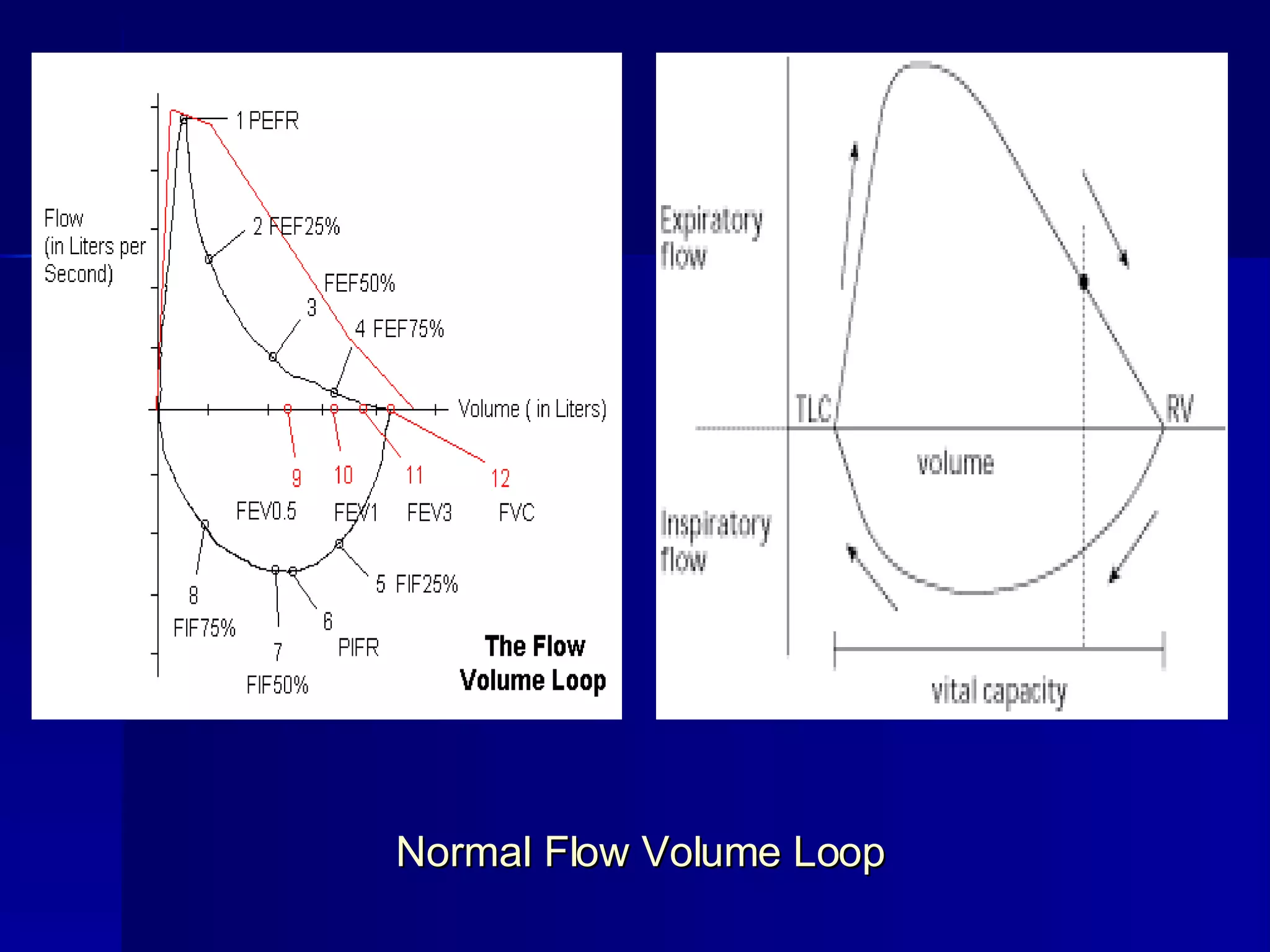 Mechanical Ventilation in ARDS vs COPD | PPT
