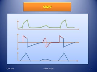 Mechanical ventilation-quiz | PPT