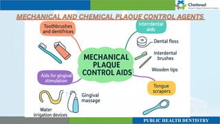 MECHANICAL AND CHEMICAL PLAQUE CONTROL AGENTS.pdf.pdf
