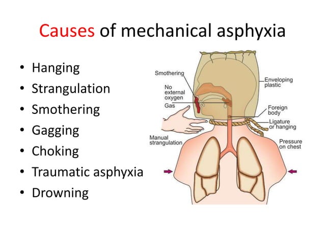 Mechanical asphyxia.pptx