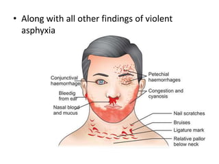 Mechanical asphyxia.pptx