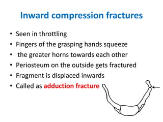 Mechanical asphyxia.pptx