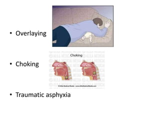 Mechanical asphyxia.pptx