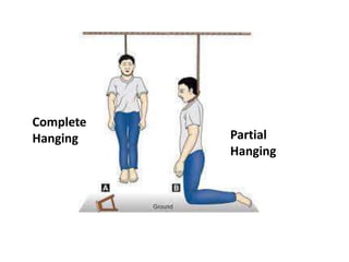 Mechanical asphyxia.pptx