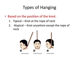 Mechanical asphyxia 1 | PPTX