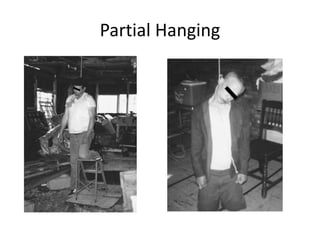 Mechanical asphyxia 1 | PPTX