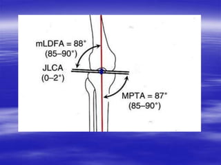 Mechanical Axis for Residents.ppt