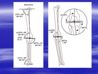 Mechanical Axis for Residents.ppt