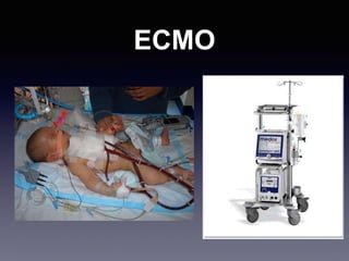 Mechanical circulatory support | PPTX