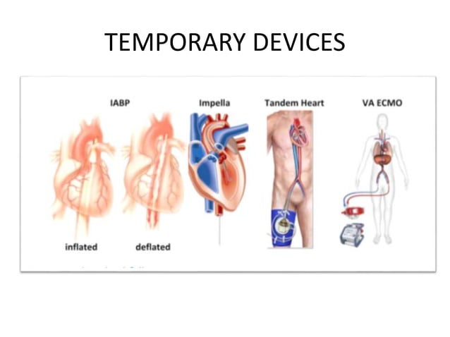 Mechanical circulatory support devices | PPTX | Heart and ...