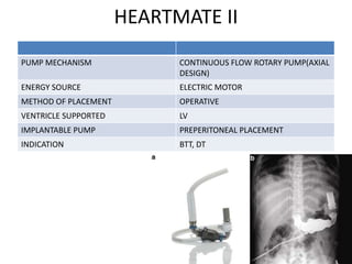 Mechanical circulatory support devices | PPTX