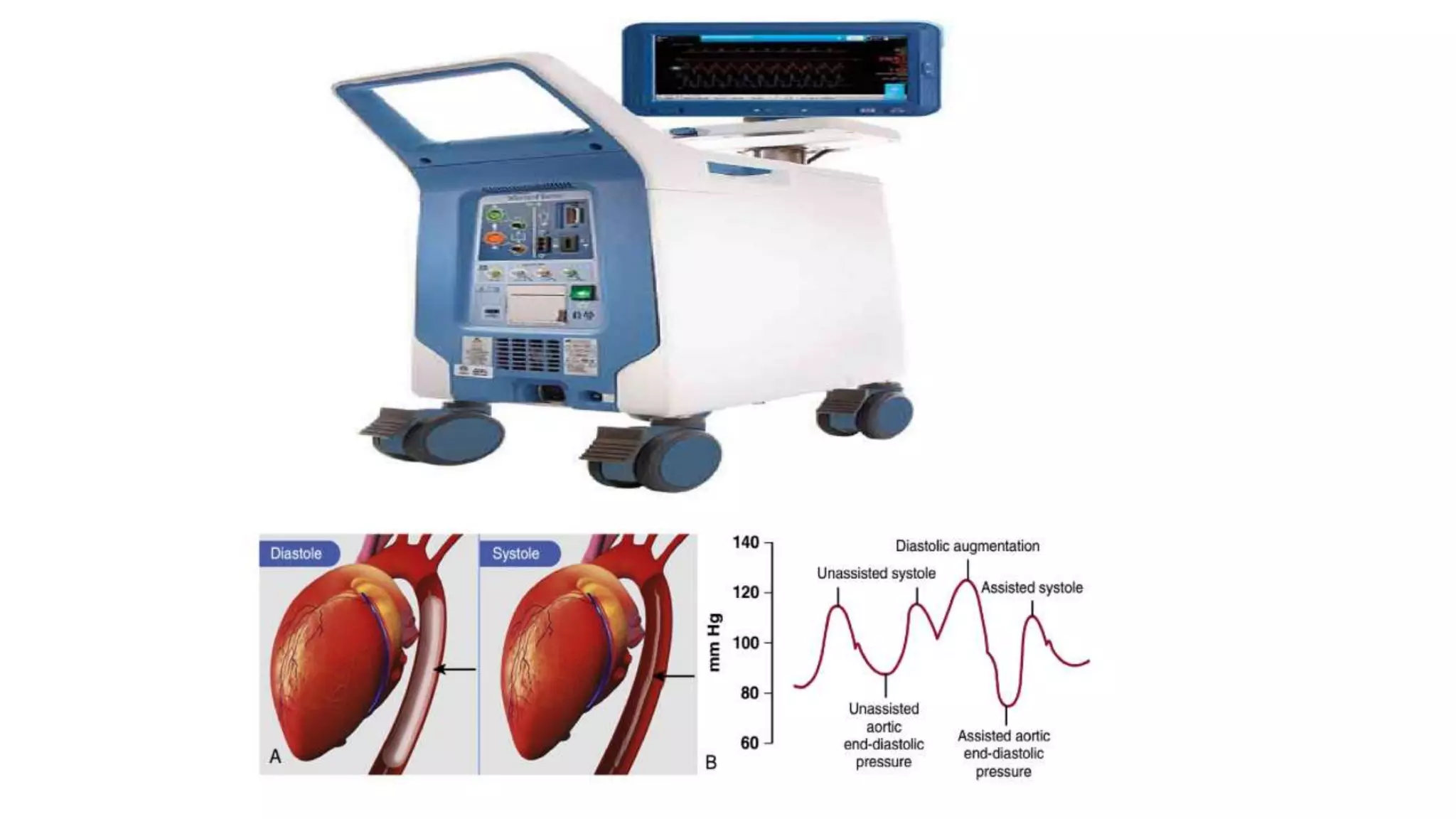 Mechanical Circulatory Support.pptx