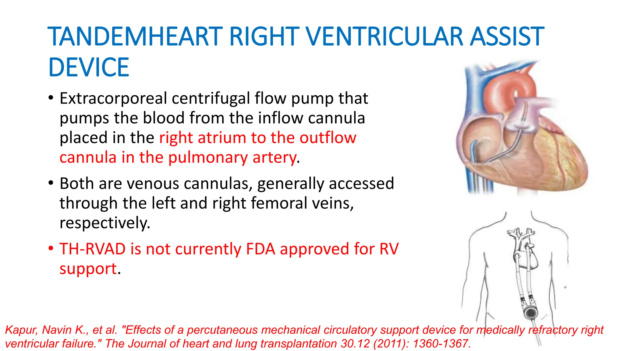 Mechanical circulatory support devices, satya.pptx