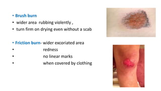 Mechanical injuries.pptx