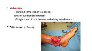 Mechanical injuries.pptx