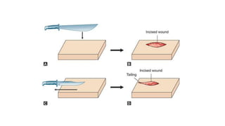Mechanical injuries.pptx