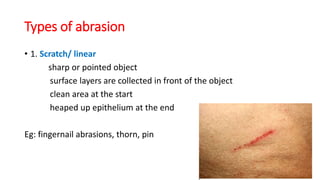 Mechanical injuries.pptx