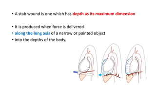 Mechanical injuries.pptx