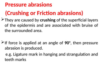 MECHANICAL INJURIES - ABRASION & CONTUSION.pptx