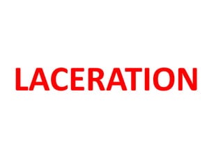 MECHANICAL INJURIES - LACERATIONS and types.pptx