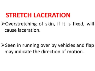 MECHANICAL INJURIES - LACERATIONS and types.pptx
