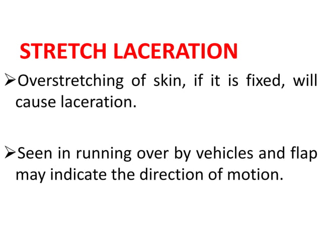 MECHANICAL INJURIES - LACERATIONS and types.pptx | Death, Injury, or ...