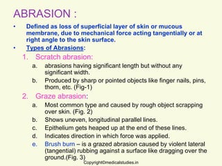 MECHANICAL INJURIES helth relateddata and information.pptx
