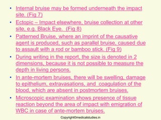 MECHANICAL INJURIES helth relateddata and information.pptx
