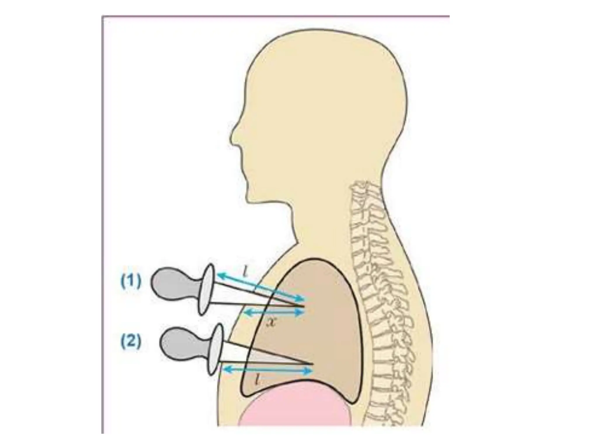 Mechanical injuries(ICS) due to sharp force.ppt
