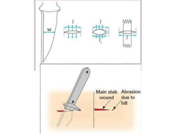 Mechanical injuries(ICS) due to sharp force.ppt