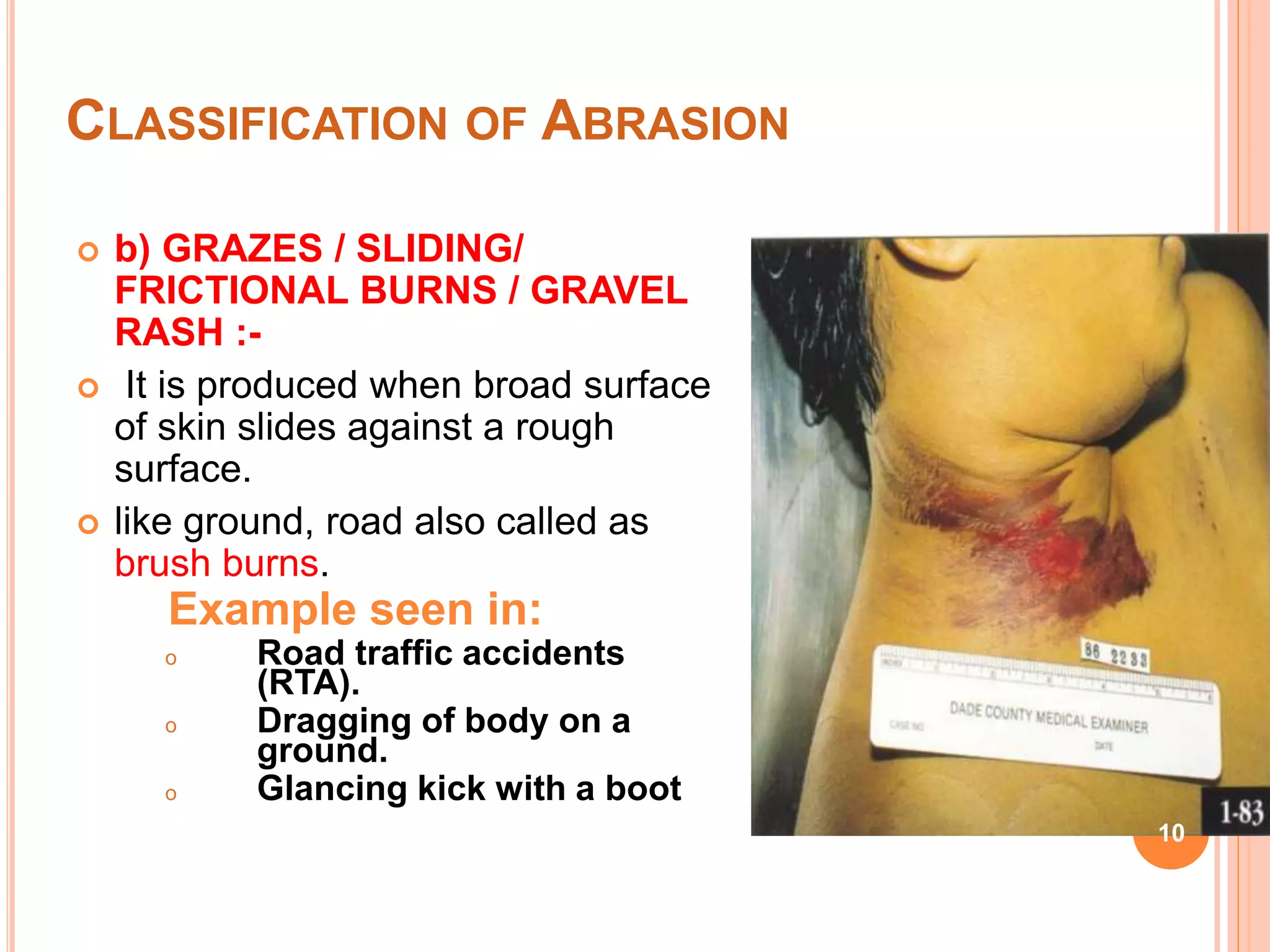 Mechanical injury 2 | PPTX