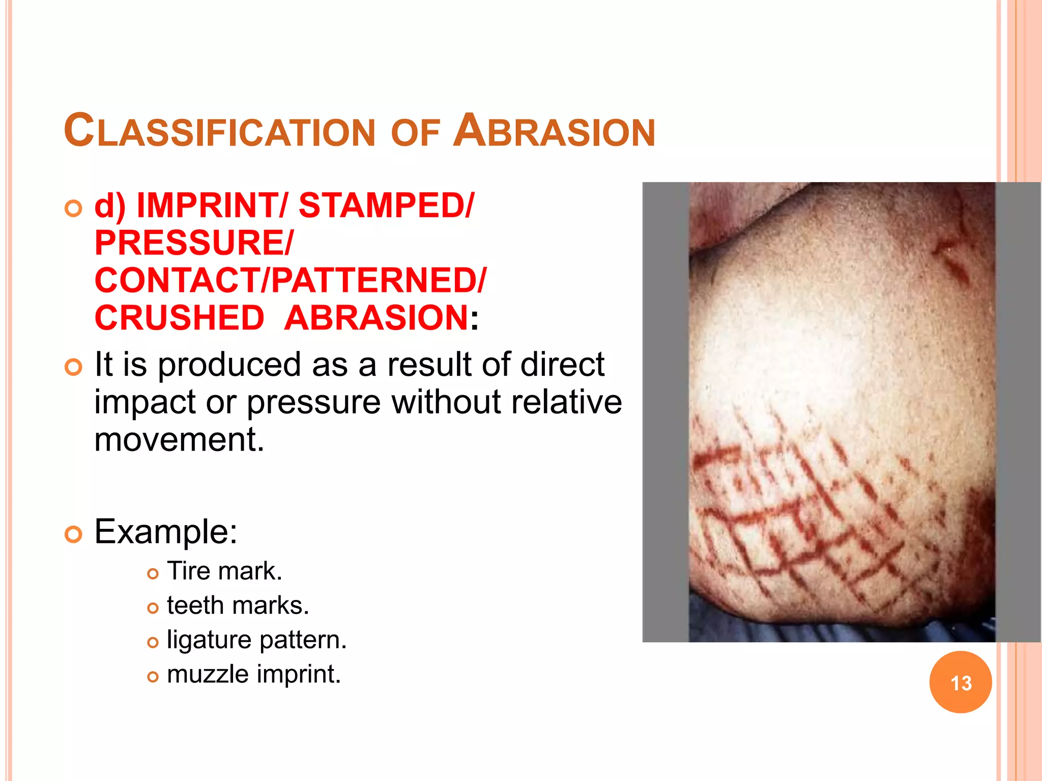 Mechanical injury 2 | PPTX