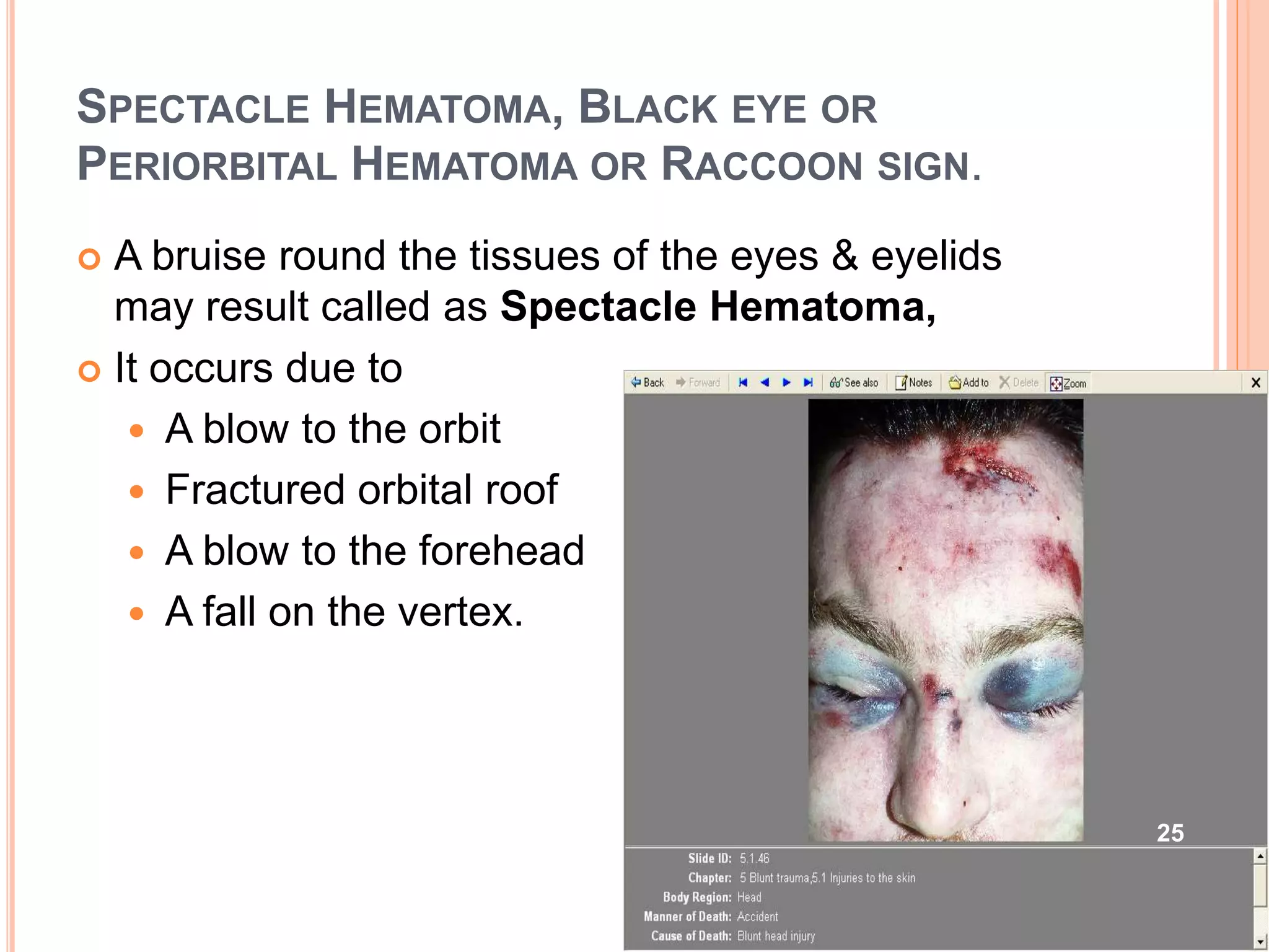 Mechanical injury 2 | PPTX