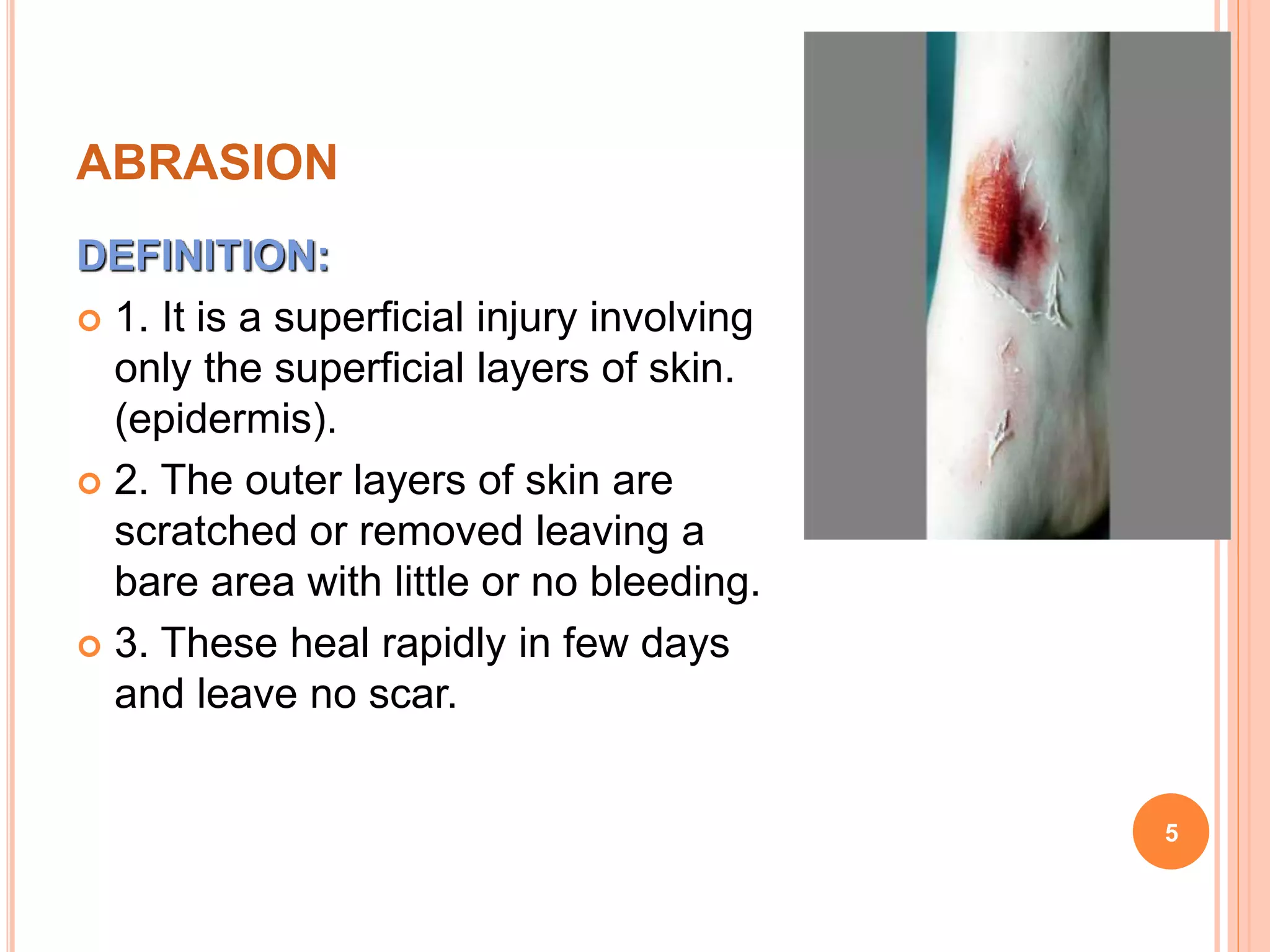 Mechanical injury 2 | PPTX