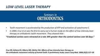 MECHANICAL METHODS IN ACCELARATING ORTHODONTICS.pptx
