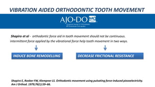 MECHANICAL METHODS IN ACCELARATING ORTHODONTICS.pptx