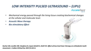 MECHANICAL METHODS IN ACCELARATING ORTHODONTICS.pptx