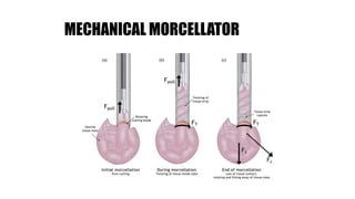 Mechanical Morcellation- Laying the controversy to rest. | PPTX