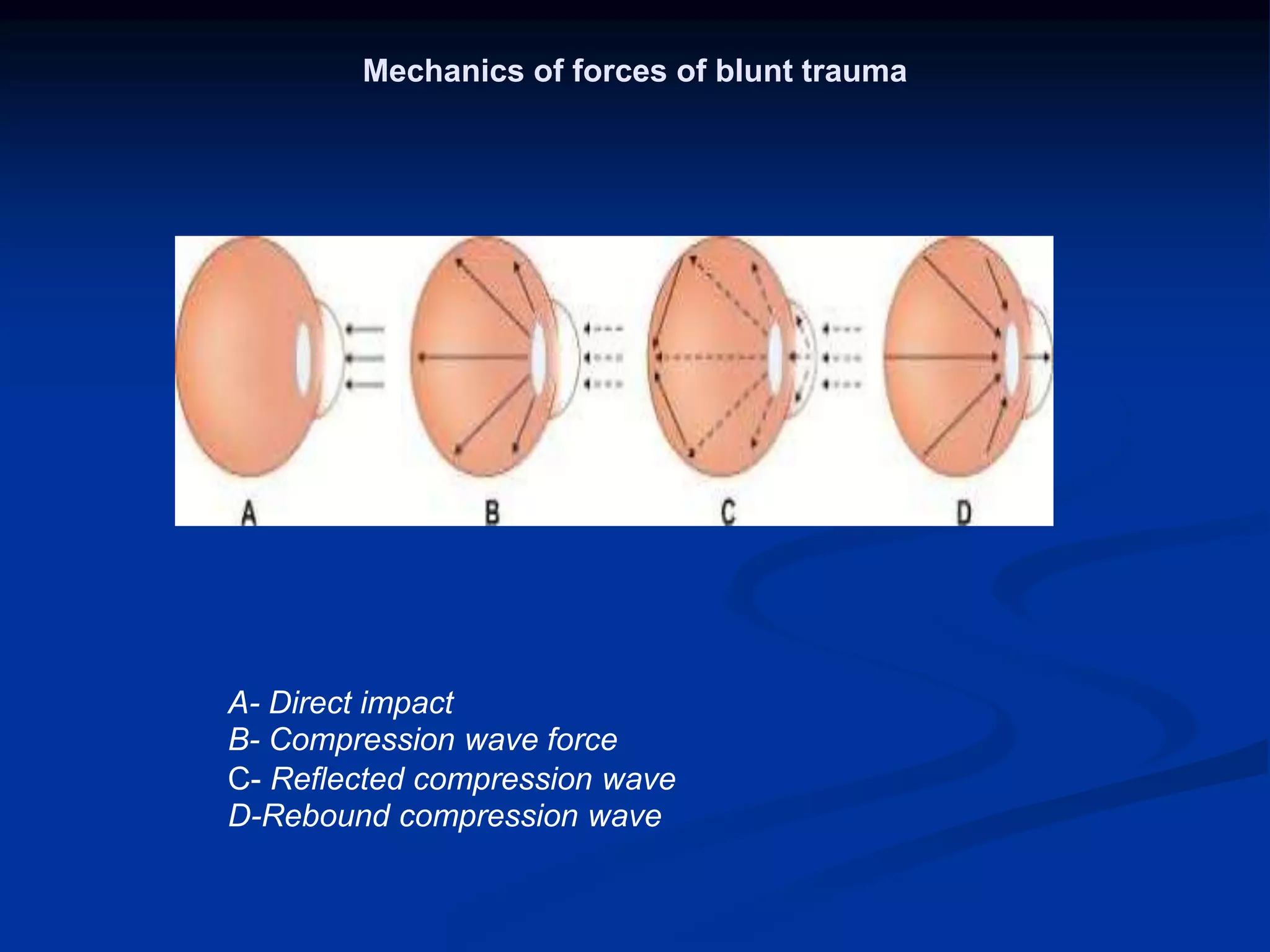 Mechanical_ocular_trauma.pptx