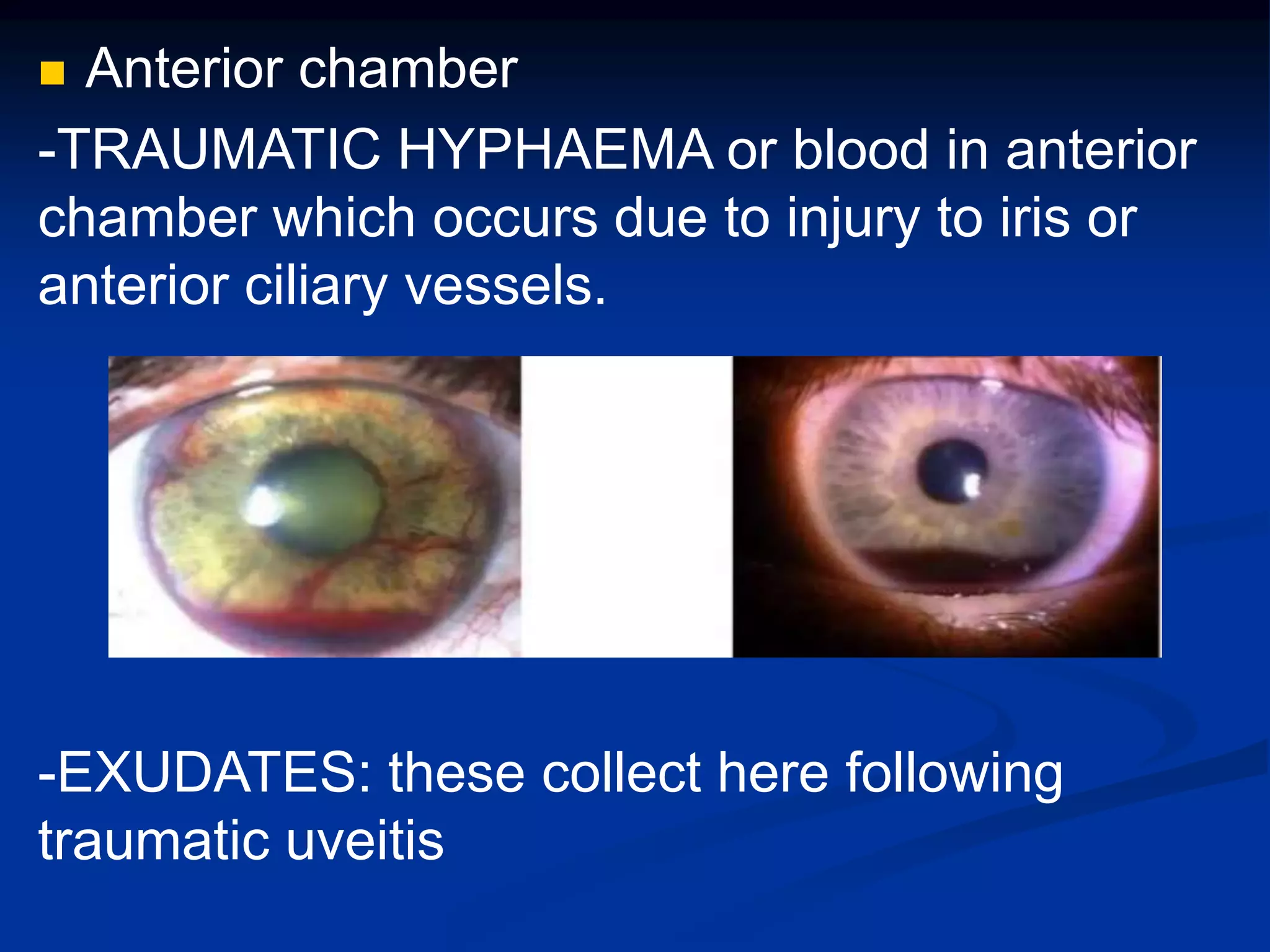 Mechanical_ocular_trauma.pptx
