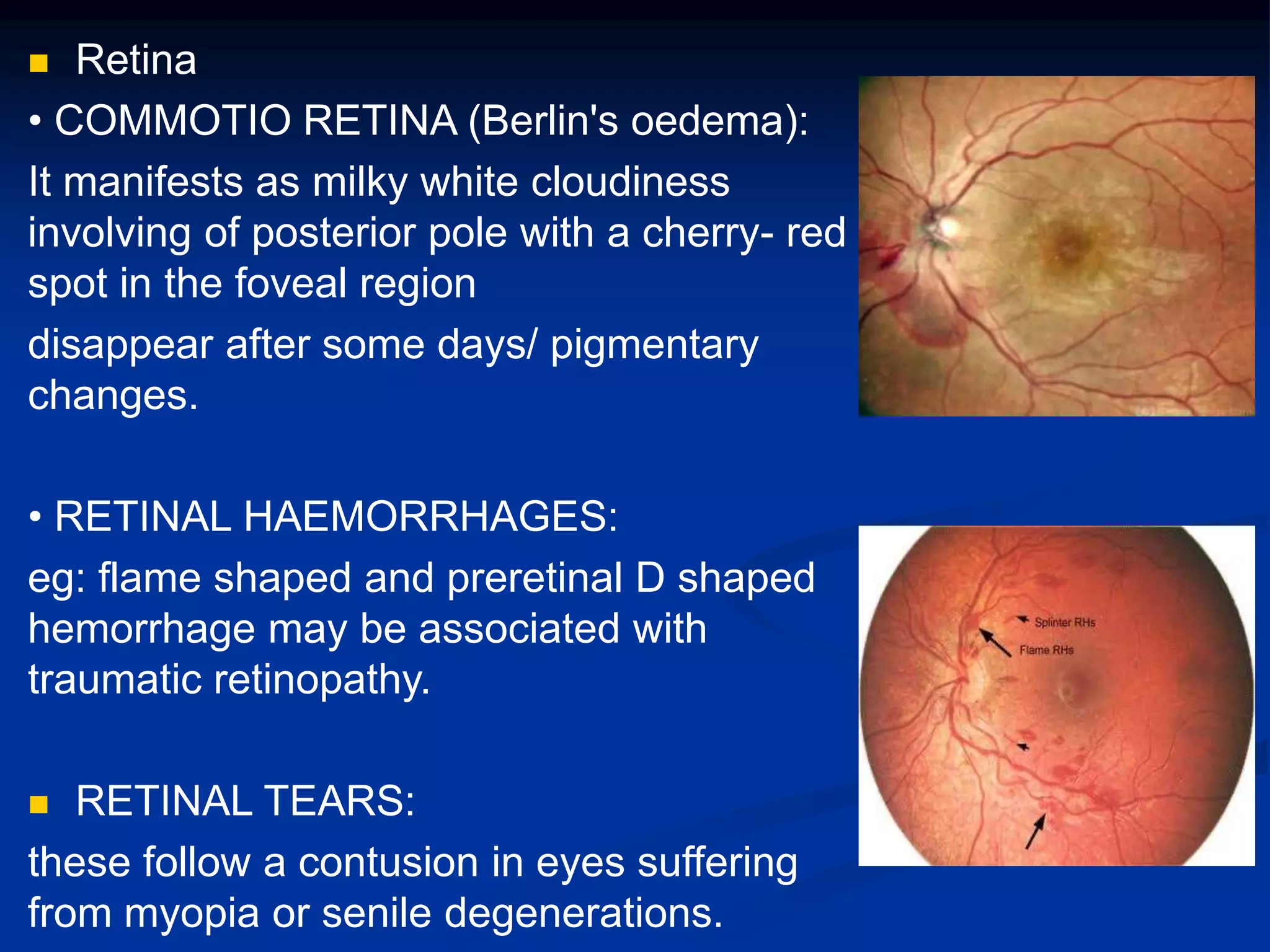 Mechanical_ocular_trauma.pptx