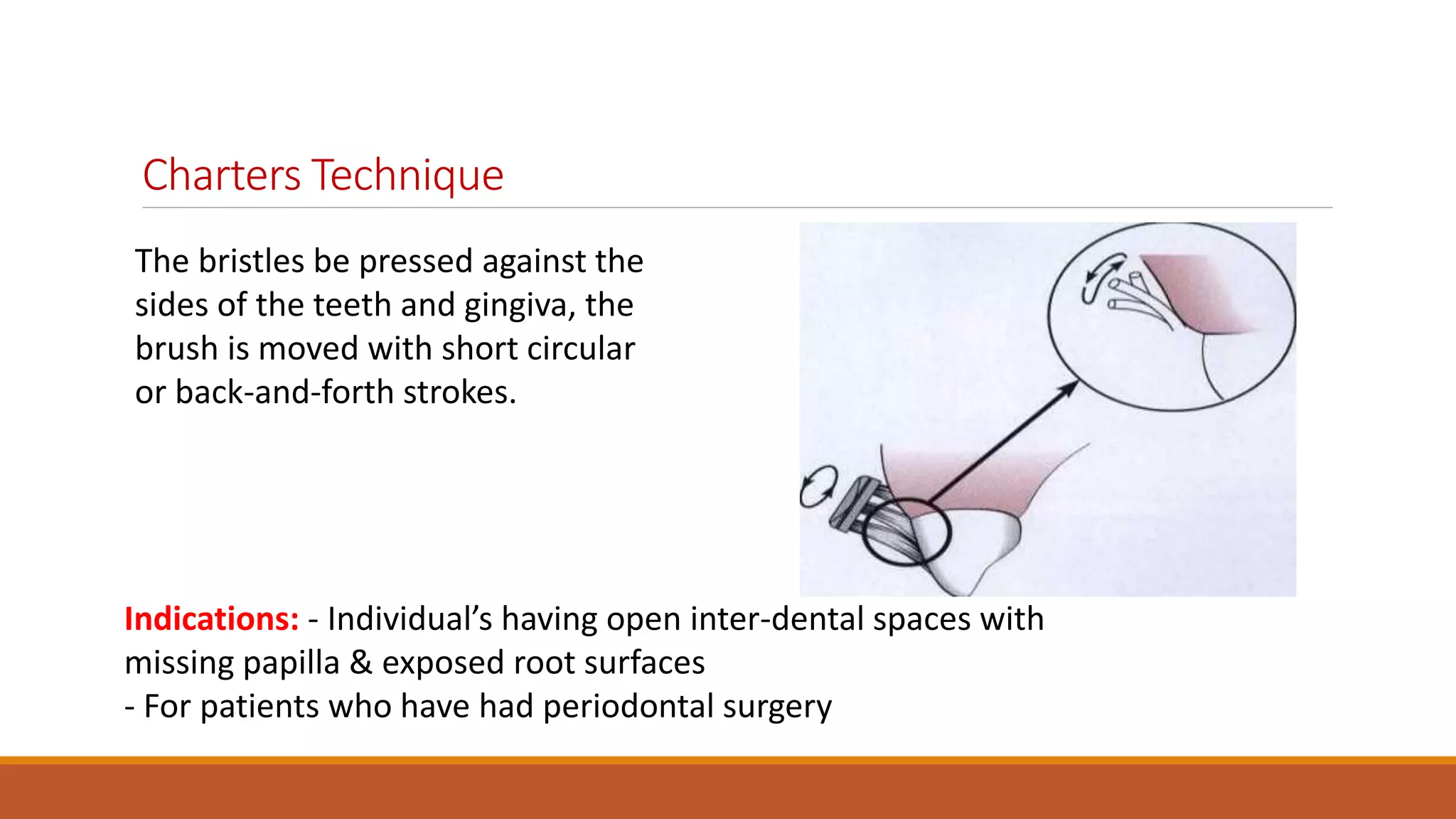 Mechanical plaque control | PPTX