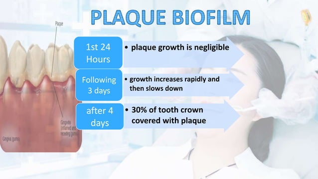 mechanical plaque control.pptx