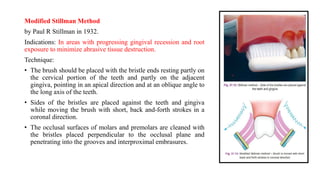 mechanical plaque control.pptx